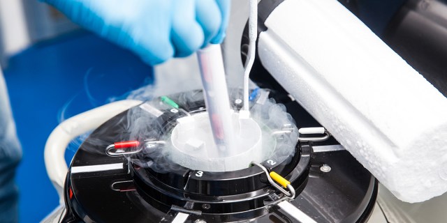 Congeler ses ovocytes ? On n’épargne pas sa vie…